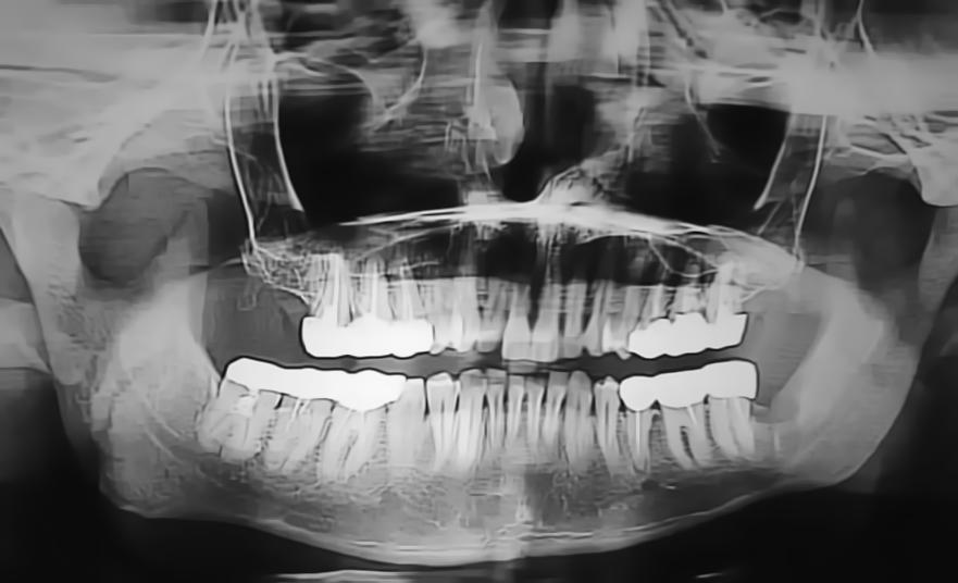 Root Canal Object Detection Dataset by lamia