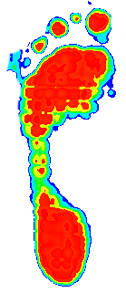 Plantar Foot Pressure Object Detection Model (v1, 2023-03-08 6:46am) by ...