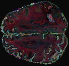 How to Use the brain Object Detection API