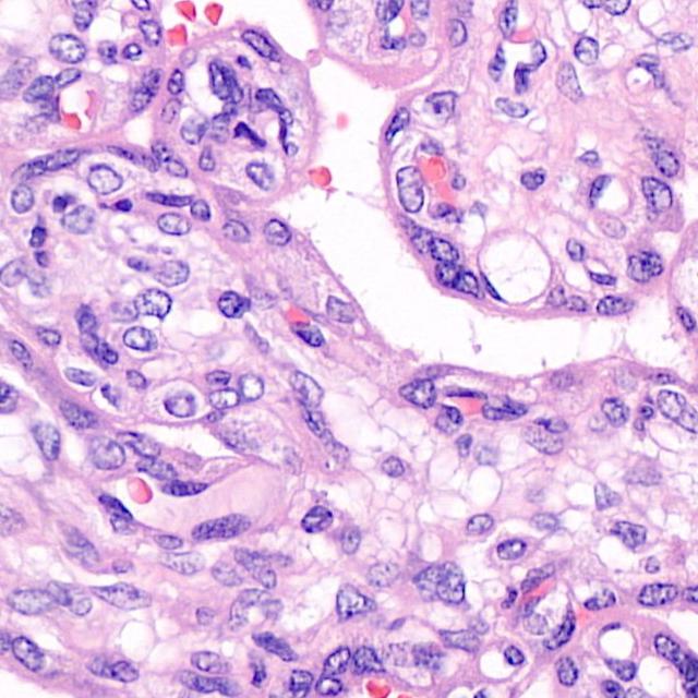 Tissue-v2 Object Detection Model by PROJECT