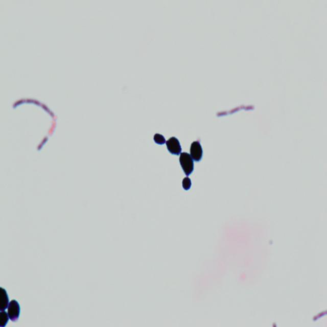 Yeast Remove Object Detection Dataset By Yeast
