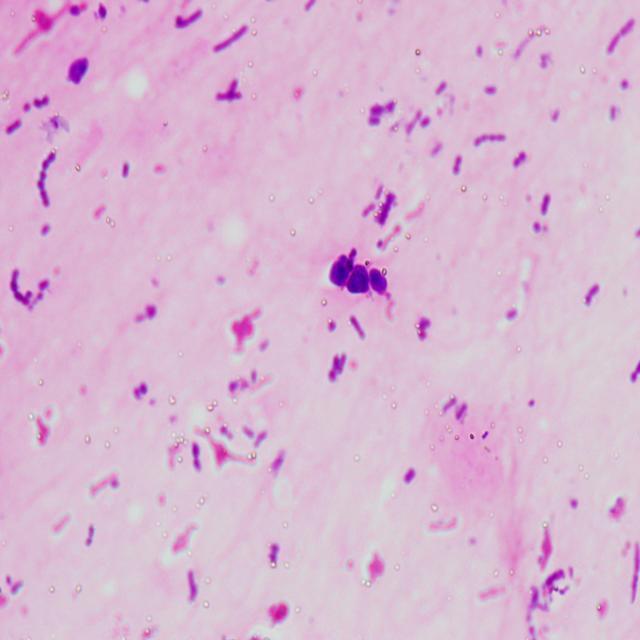 3bacteria Object Detection Dataset by yeast