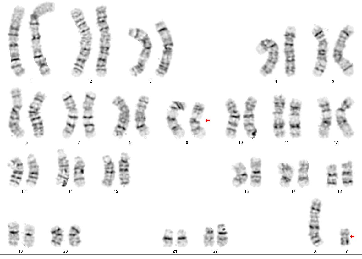 Anomaly Identification Object Detection Dataset And Pre Trained Model