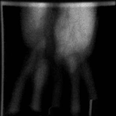 How to Use the X-Ray Fluidised Bed Instance Segmentation API