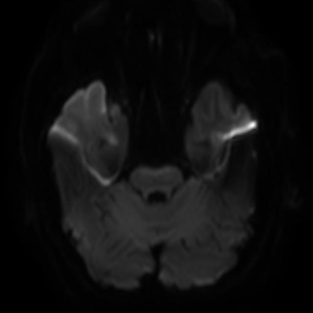 brain Instance Segmentation Dataset by Danish Barkat