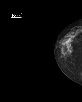 akif (akif-8dfva) - Roboflow Universe