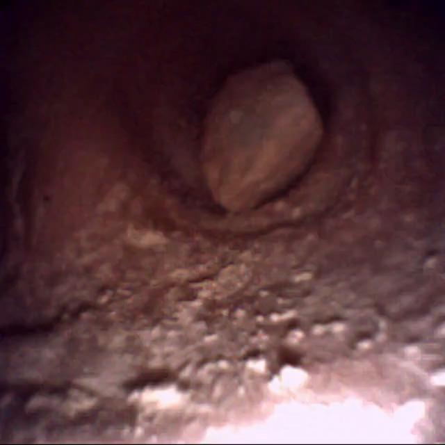 Stone Detector Object Detection Dataset and Pre-Trained Model by David Ehrenberg