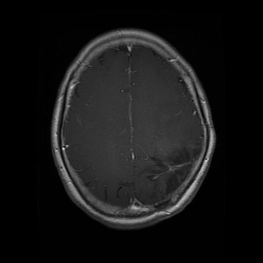 ML lab 4 - Roboflow Universe
