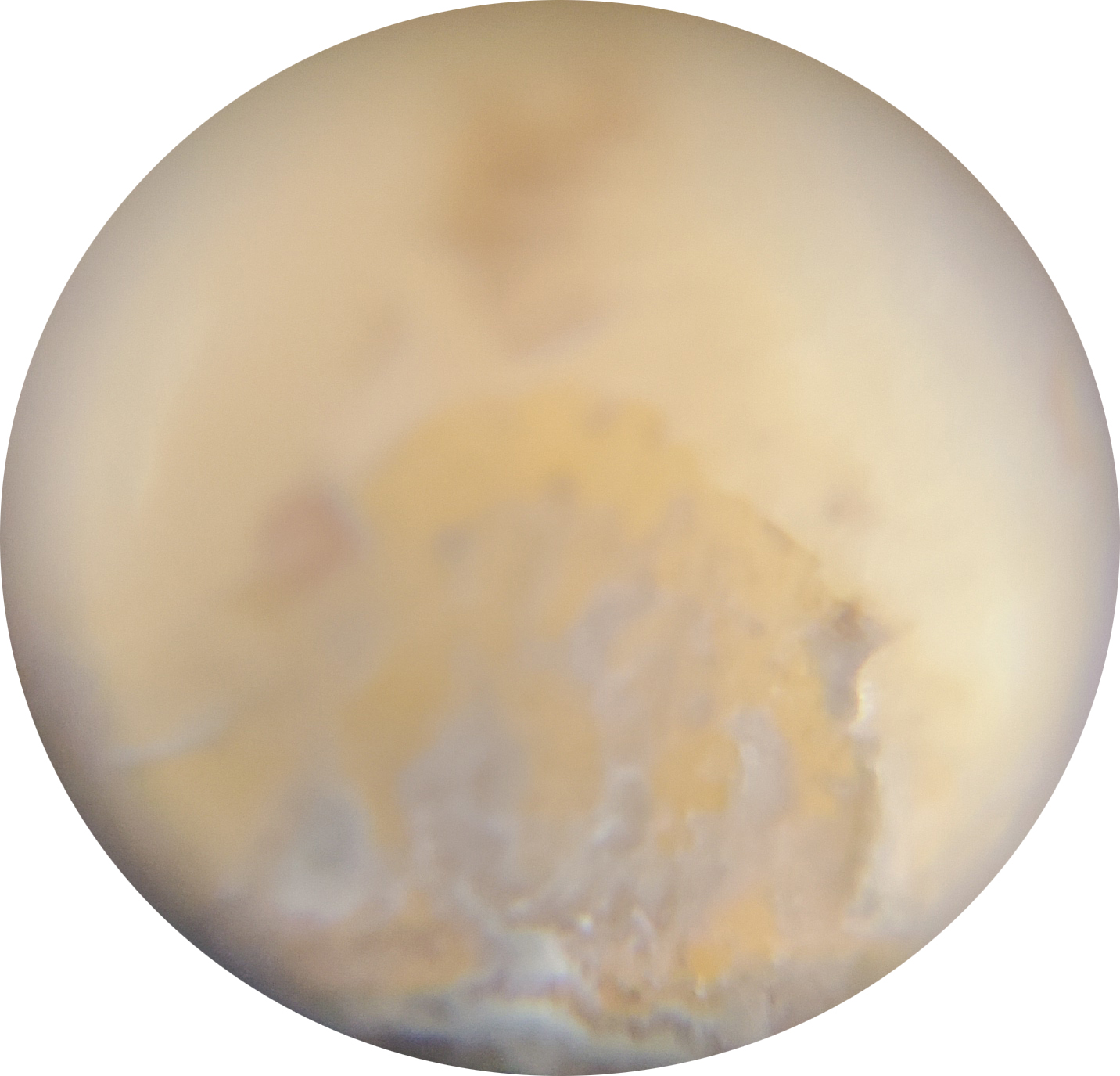 Root canal cavity checkup Object Detection Dataset by north south ...