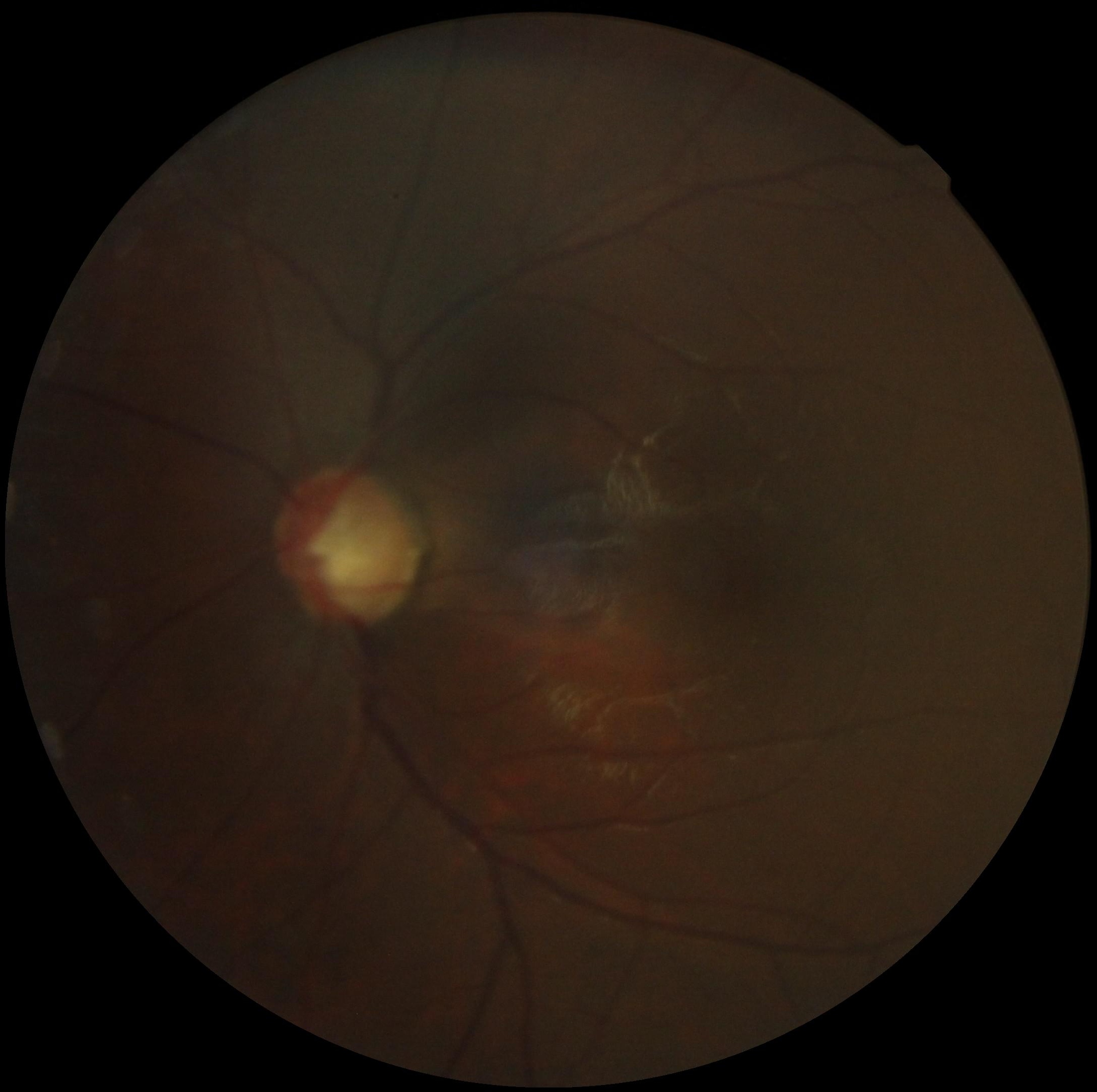 eye-disease-classification Classification Model by hari narayanan