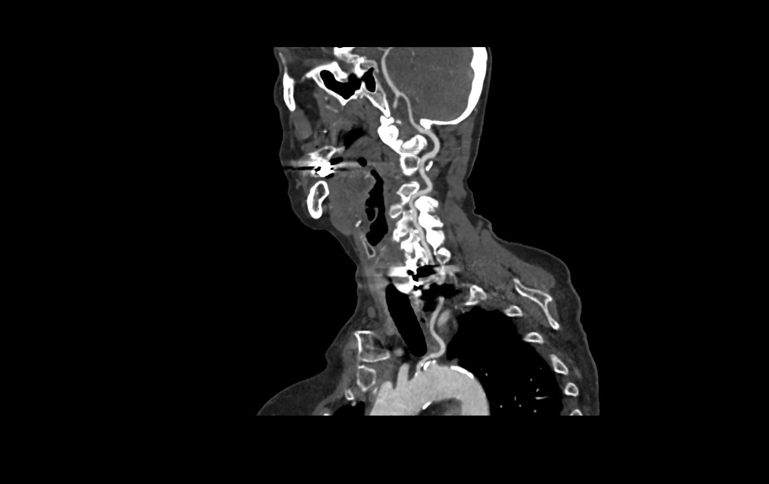 Dicoms Instance Segmentation Dataset by Graduation Project
