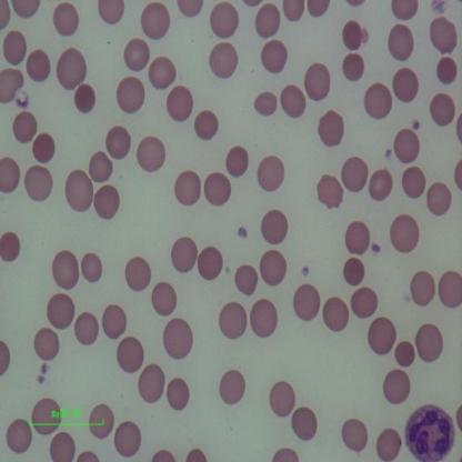 bccd-yolov5 Object Detection Model by KMIT