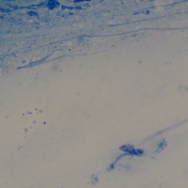 TBC Yolo (one class) Instance Segmentation Dataset by TransUNetTBC