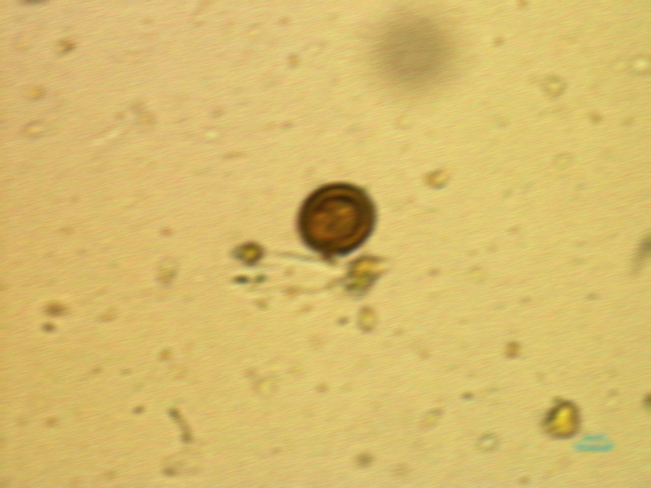 Taenia spp. egg Object Detection Dataset by school