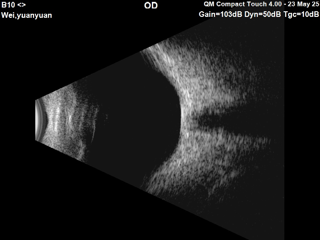 New eye datasets Object Detection Model by Leijianji