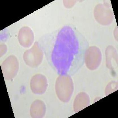 WBC Screenor Object Detection Dataset and Pre-Trained Model by BlocksHub