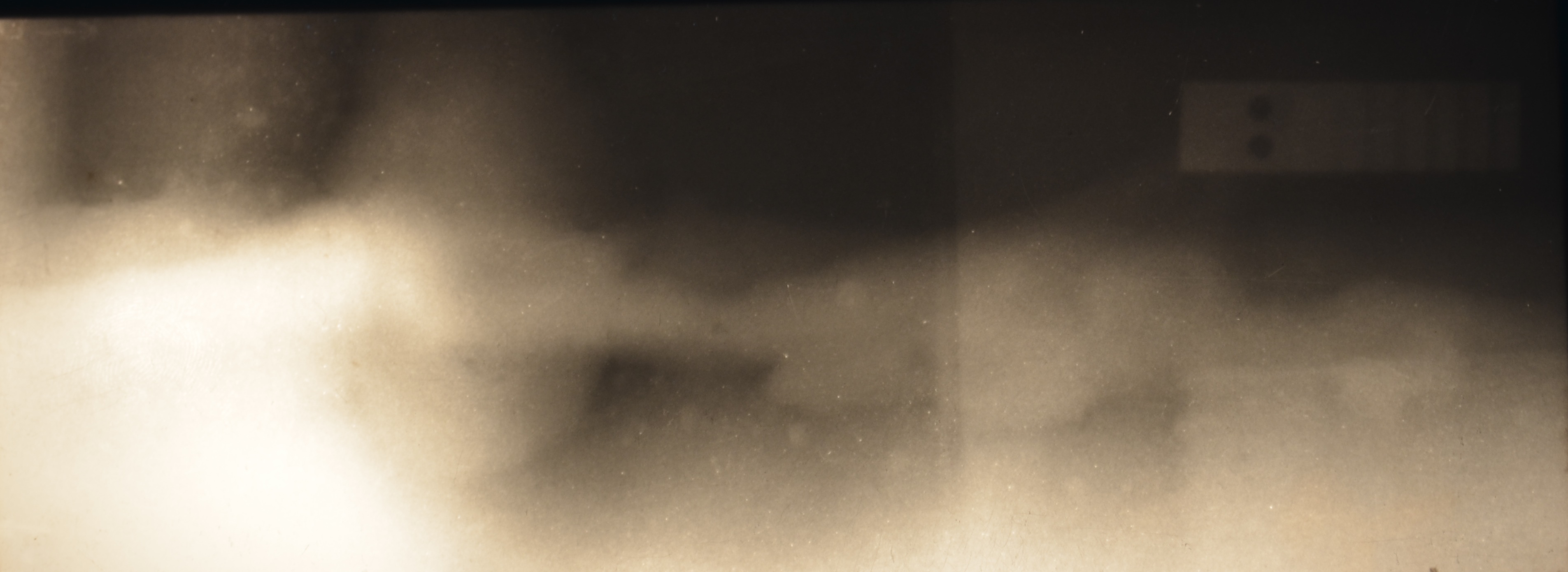 rentgen_defects Instance Segmentation Dataset by alex574