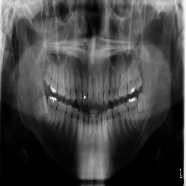 vzrad2 Instance Segmentation Dataset by project1