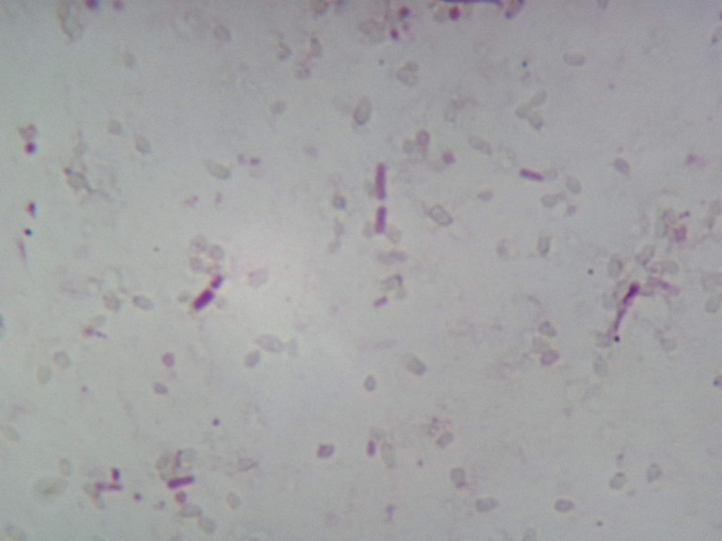 Bacillus - Roboflow Universe