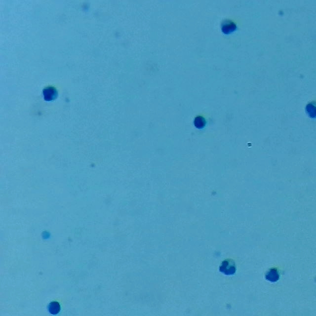 blood cell detection v3 Object Detection Model by 1021bloodcelldetect