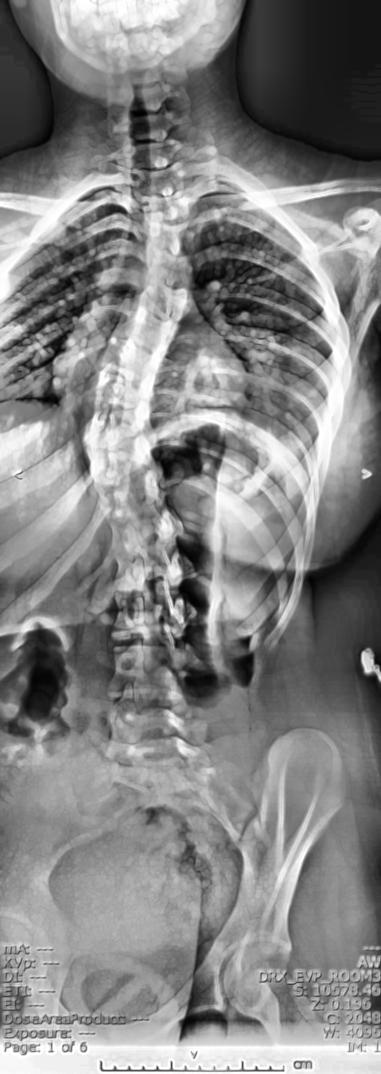 How to Use the spine Instance Segmentation API