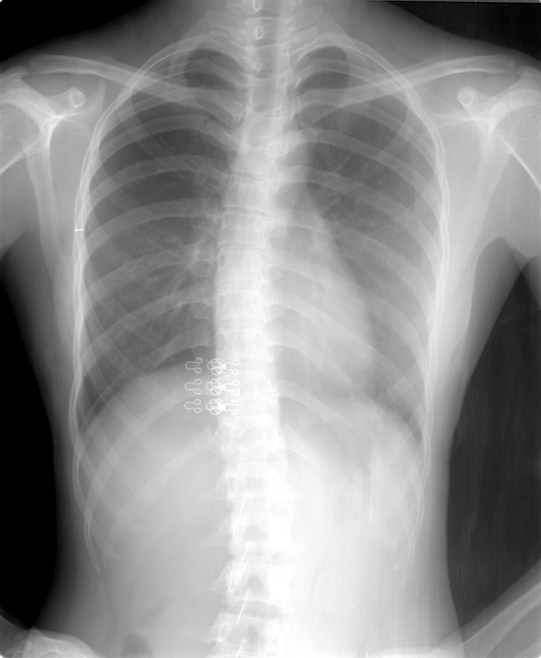 X-Ray Segmentation Instance Segmentation Dataset by umut