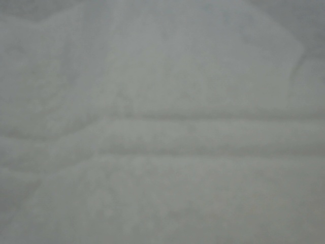 wrinkles Instance Segmentation Dataset and Pre-Trained Model by hanbao