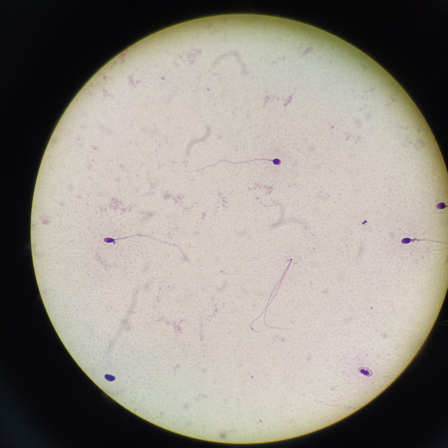 4 Batch Object Detection Dataset By Yzproje