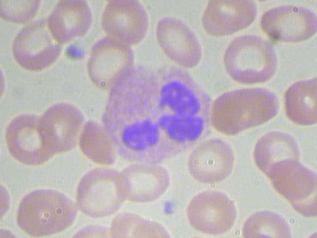 Blood Cell Object Detection Dataset by My Workspace