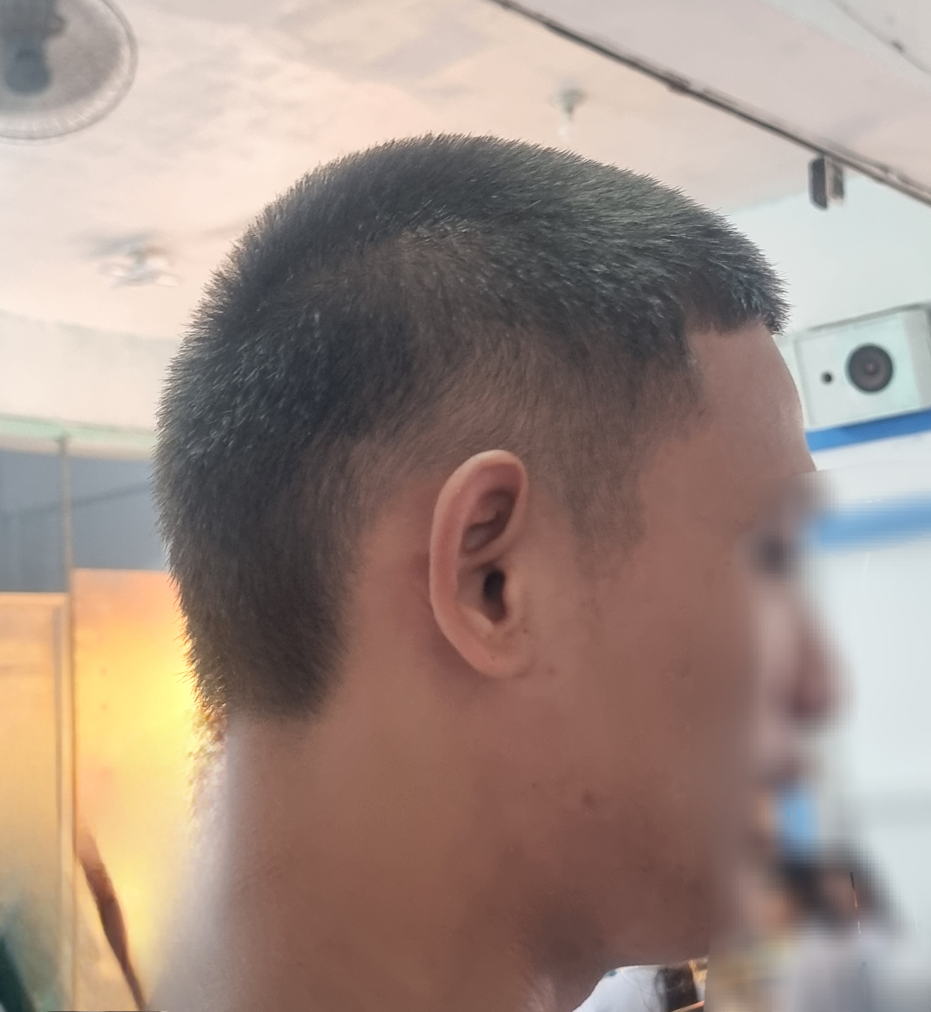 Types Of Hairs Object Detection Model by HAIR