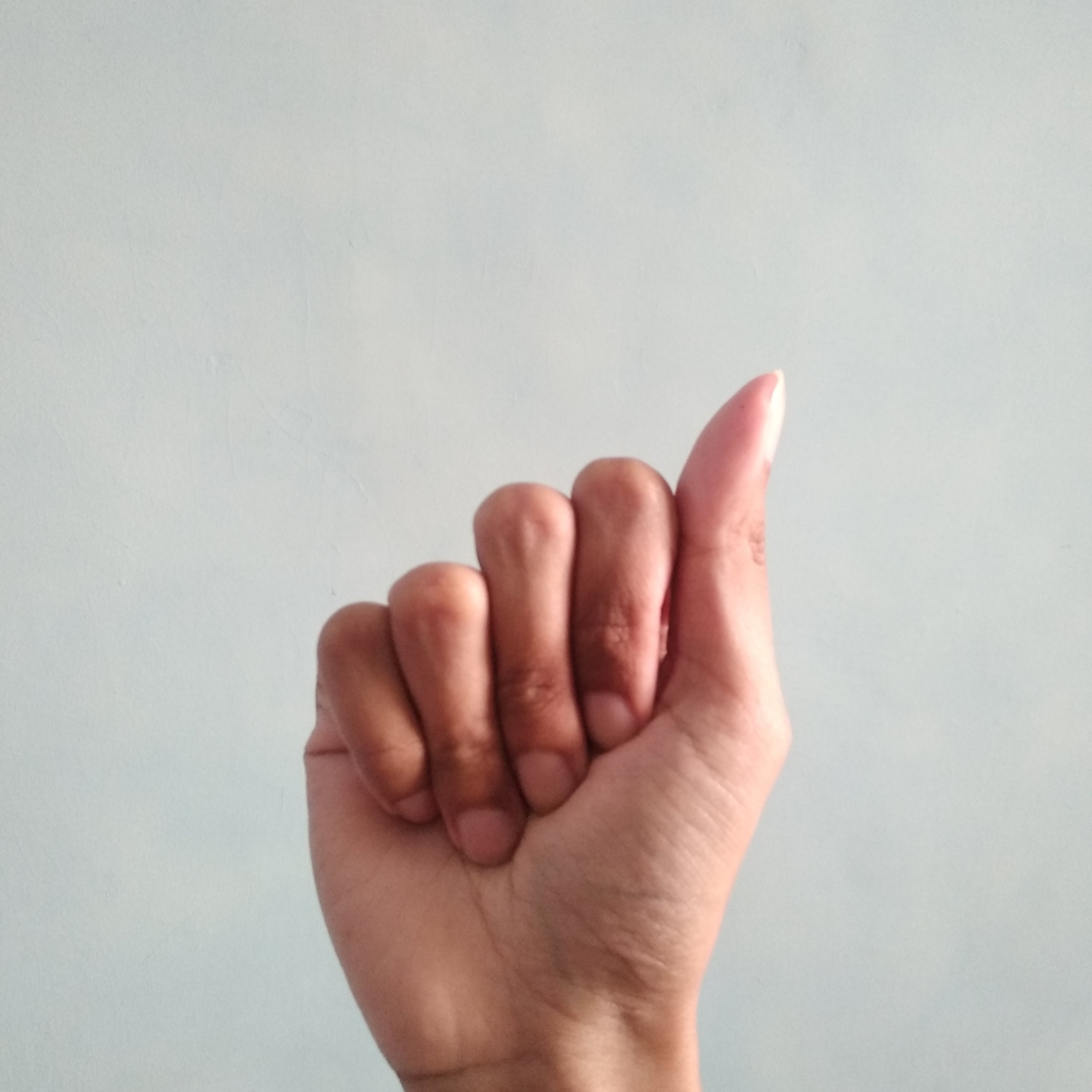 Computer Vision (computer-vision-jdv6a) - Roboflow Universe