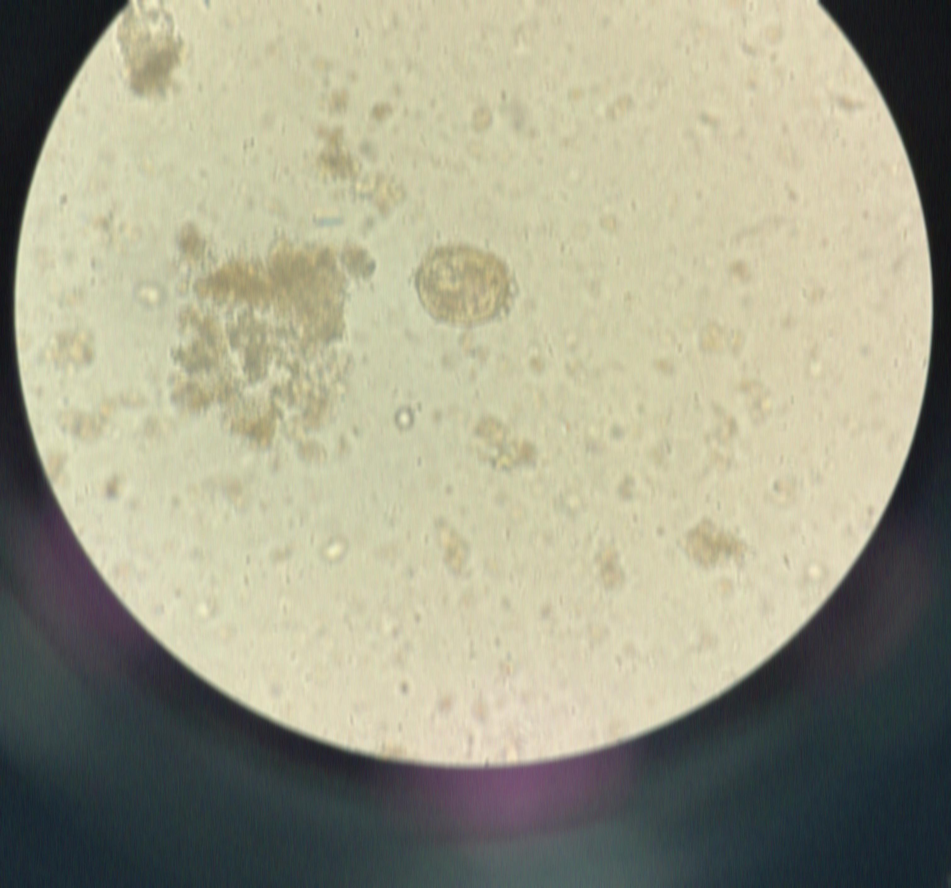 Parasite Computer Vision Dataset by AI Indonesia