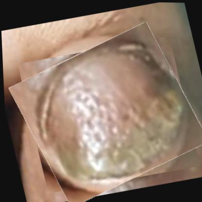 Nail Disease Classification Dataset by Machine Learning