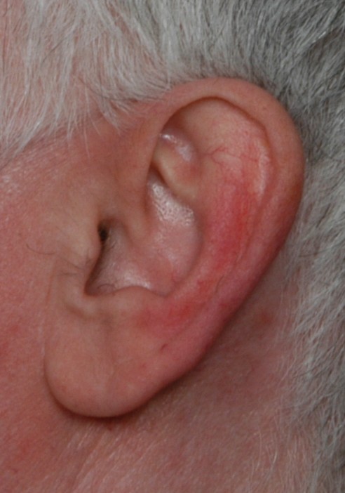Ear recog Classification Dataset by dvdvd