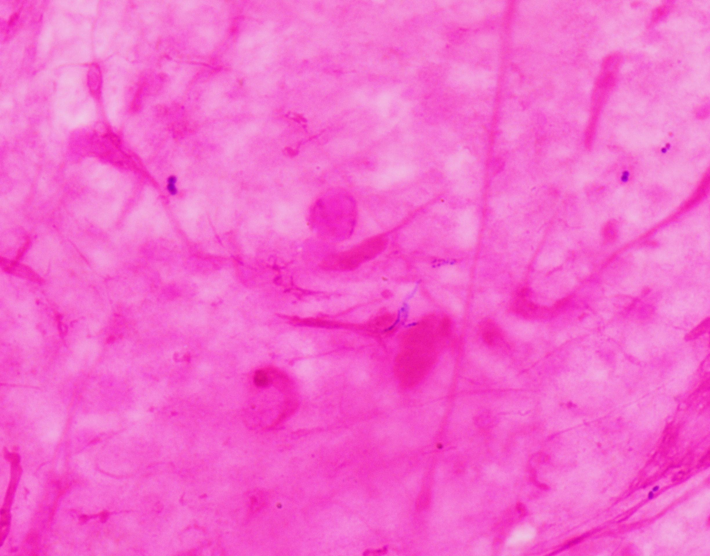 Mycobacterium 1 Object Detection Dataset And Pre Trained Model By Kdicons1
