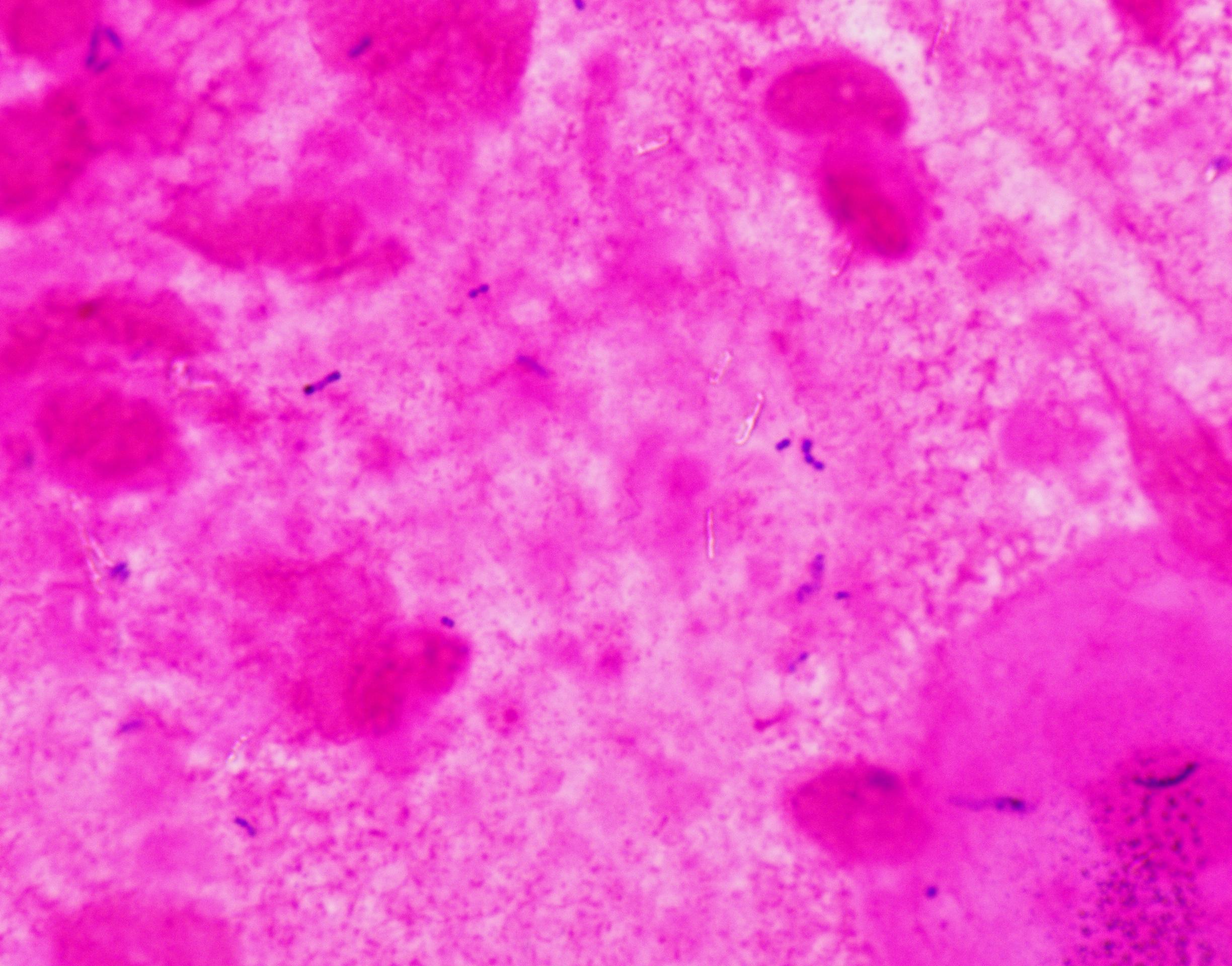 Mycobacterium 2 Object Detection Dataset By Kdicons1