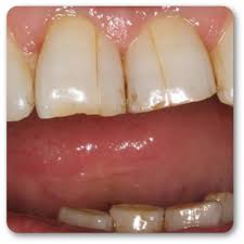 Reference_marking_new Instance Segmentation Dataset by oralaiannotationteama