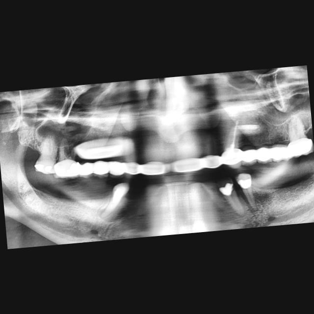 P Prueba 5 Object Detection Dataset By Caries