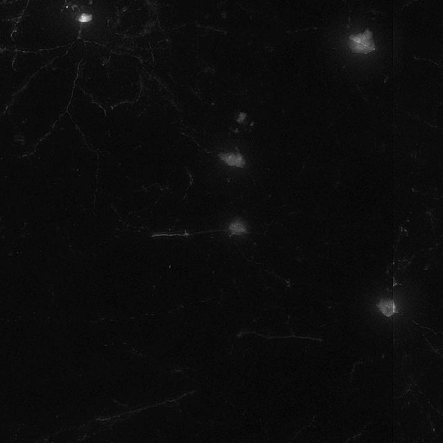 Neuron Nuclei Detection Object Detection Dataset By Labor 