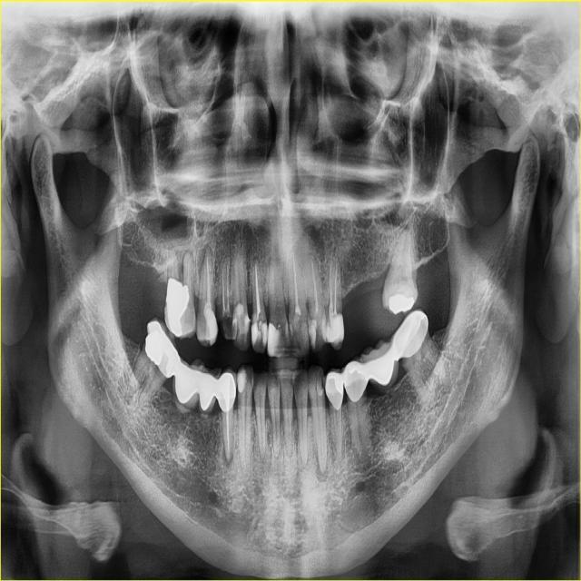 Dental Teeth Problem Object Detection Dataset By Tu Darmstadt
