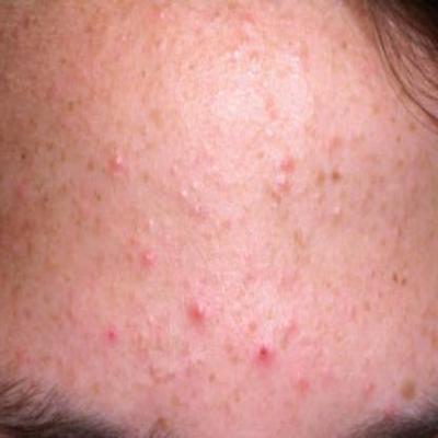 Tugas Akhir2024 - Roboflow Universe