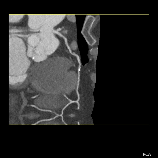 pvp Instance Segmentation Dataset by Seg and Count