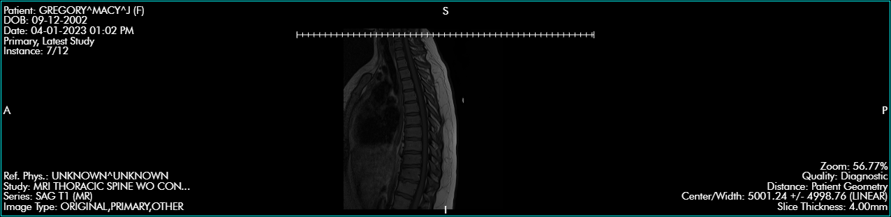 chiari-mri-detection Instance Segmentation Dataset and Pre-Trained Model by Ece Zeliha Kapc