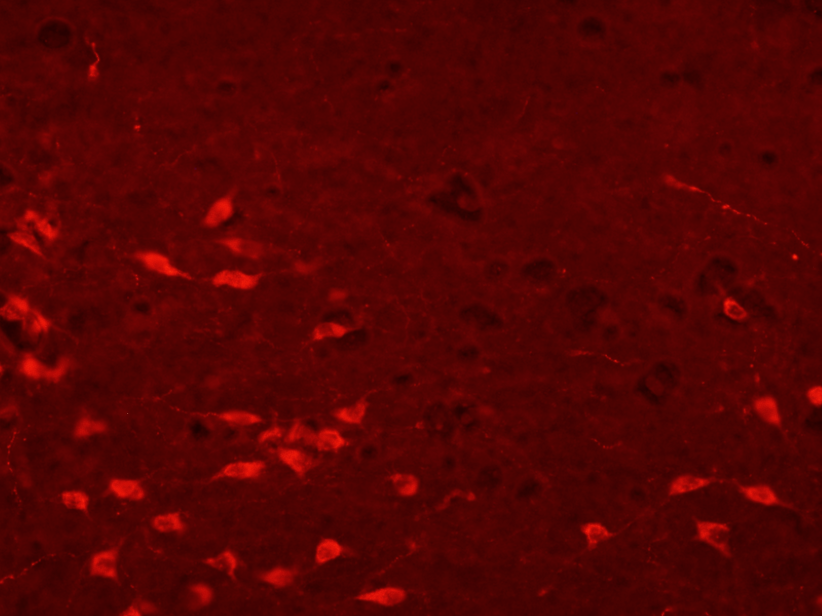 Neuron Somata Object Detection Dataset by fluro cells v2