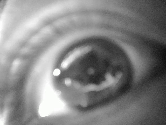 eye_segment Instance Segmentation Model by eyeseg