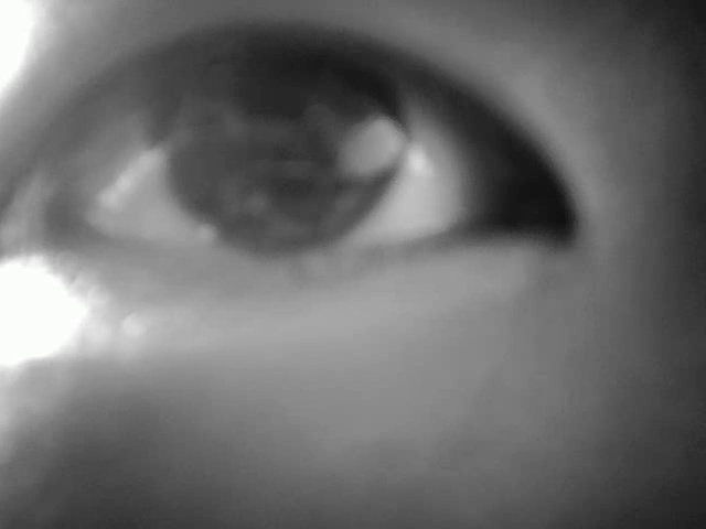 eye_real Instance Segmentation Dataset by eyeseg