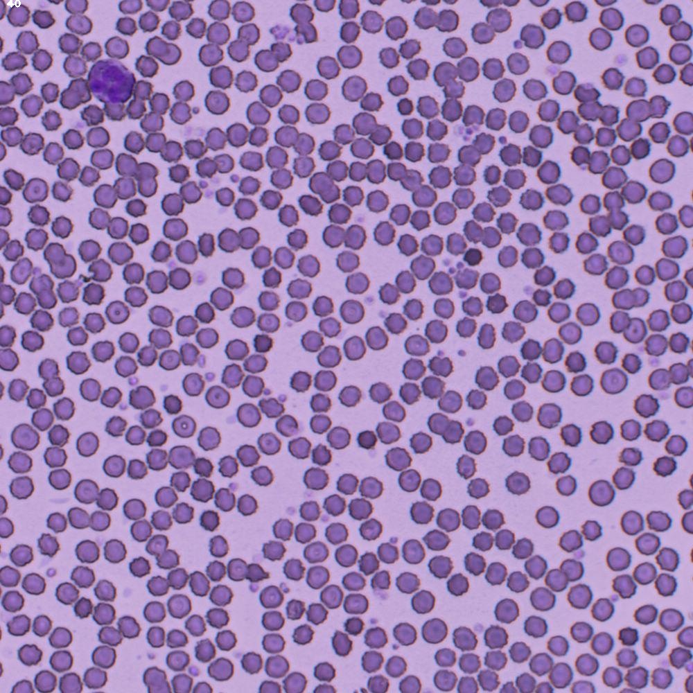 Balanced 5 E WBC Object Detection Dataset by Devora Weintraub