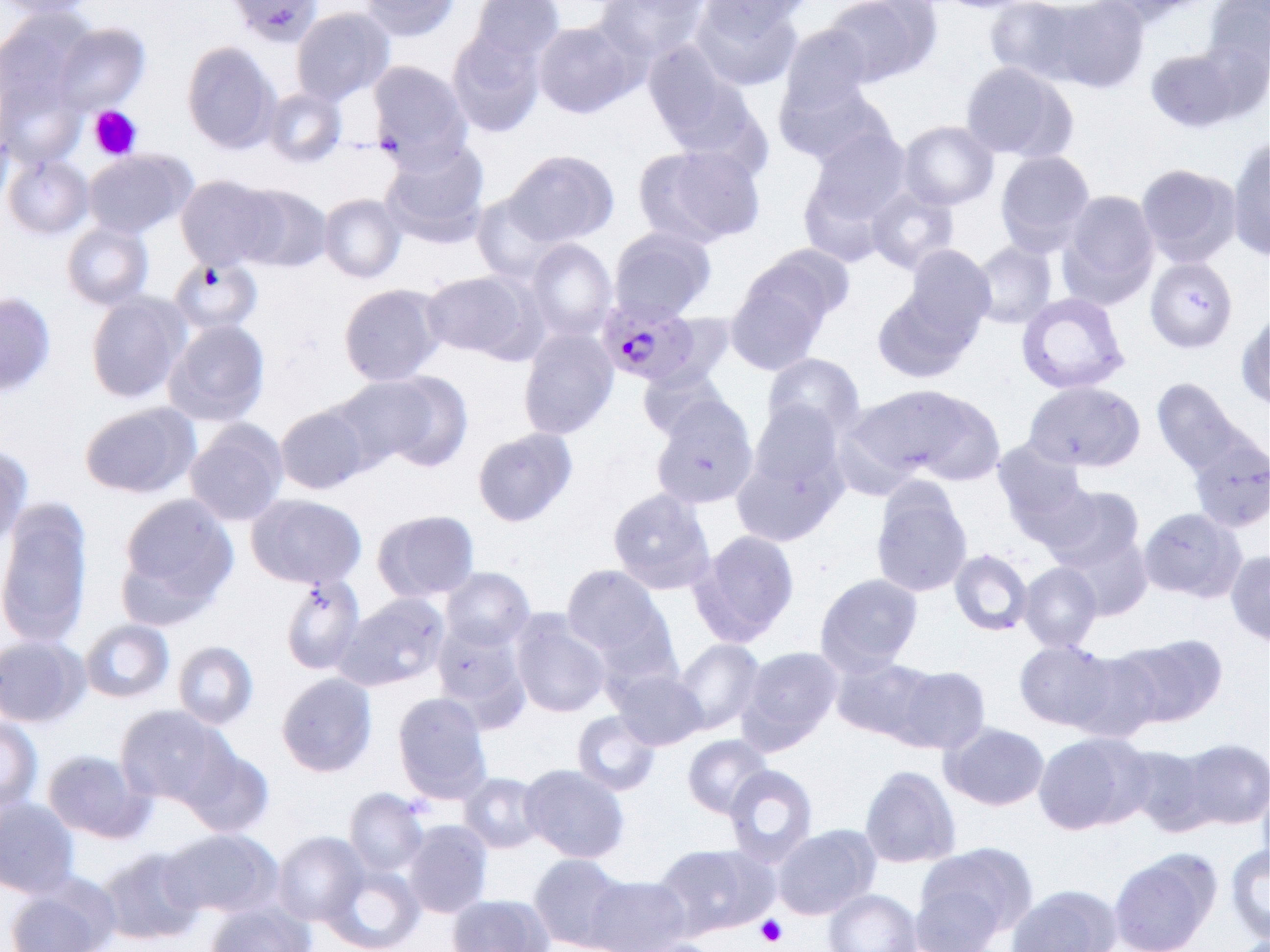 Yolov11 Object Detection Dataset By Unamed