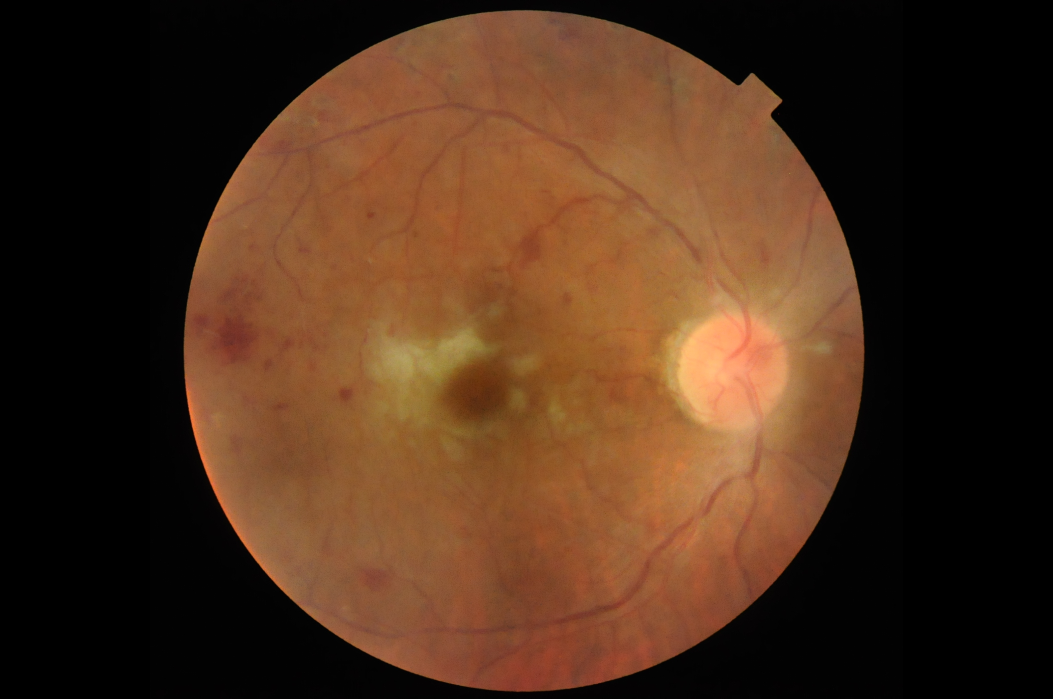 dr_train Instance Segmentation Model by broken