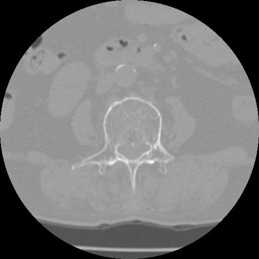 lumber_yolo3 Object Detection Dataset by School